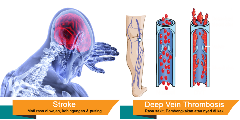 Inflamasi & D-Dimer – VLI Health